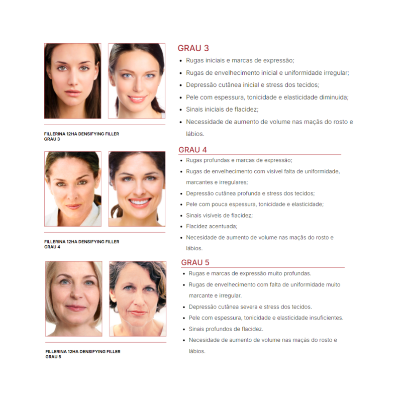 Fillerina 12HA Creme de Contorno de Olhos Grau 5 15ml